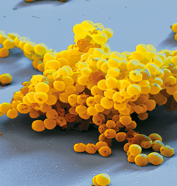 Gibt es auch eine Listung für Produkte zur MRSA-Hautsanierung?