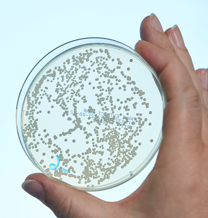 Bacteria in the operation room