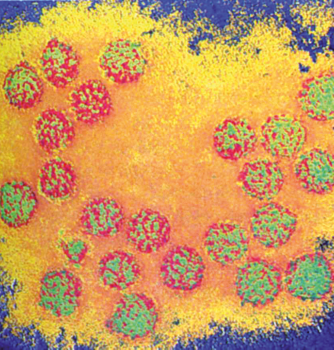 Hygiene measures for HP viruses in the operating room